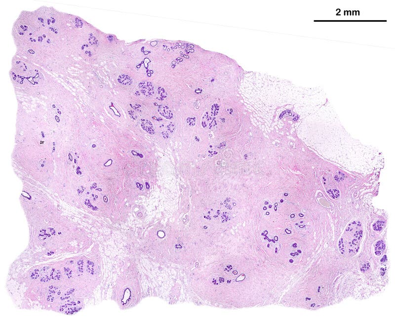 Human breast stock photo. Image of body, stroma, terminal - 288379522