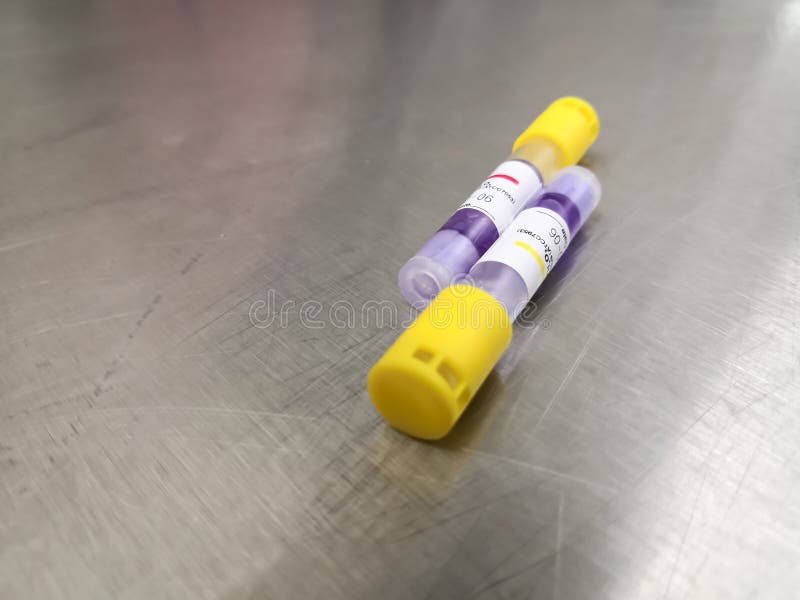 Steam Sterilization Biological Indicator Stock Image - Image of ...