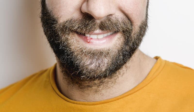 137 Man Beard Lower Face Stock Photos - Free & Royalty-Free Stock ...