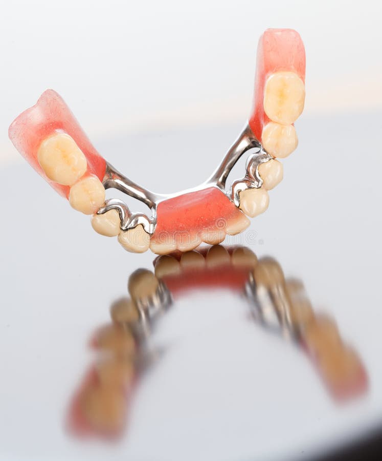 Dental Skeletal Prosthesis - Front View Stock Image - Image of ...