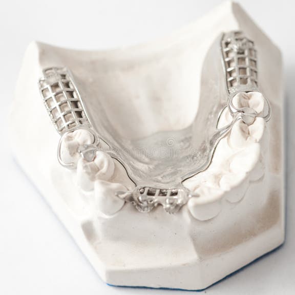 Lower Partial Denture with Attachments Stock Photo - Image of ceramics ...