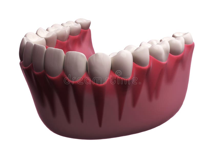 Braces stock illustration. Illustration of anatomy, mouth - 23699530