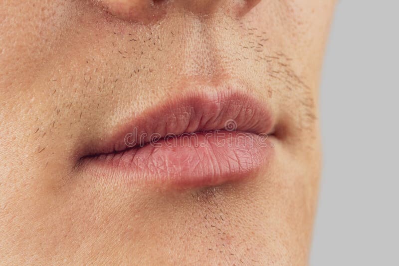 The Lower Third of a Man S Face, the Structure of the Nasolabial Folds ...