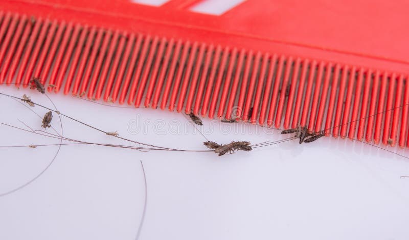 Luizen in haar en kam stock afbeelding. Image of fauna - 153072635