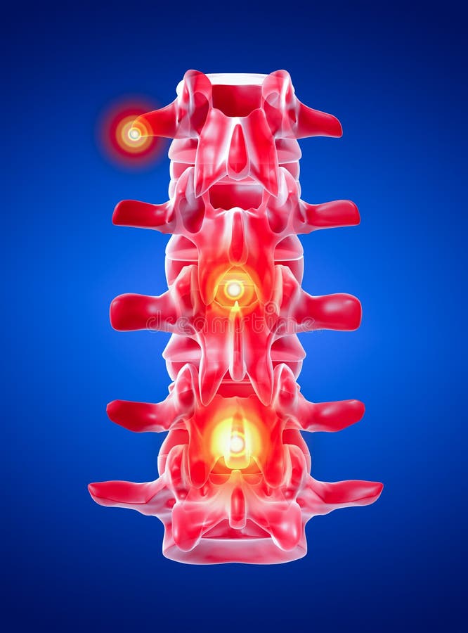 3D Rendering Illustration Of Lumbar Stock Illustration - Illustration ...