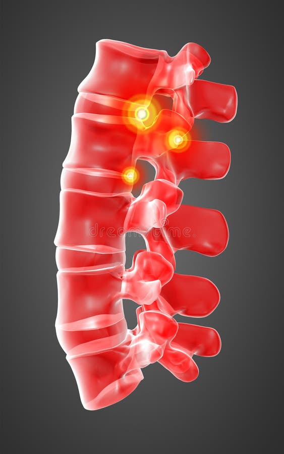 3D rendering of lumbar stock illustration. Illustration of back - 227883670