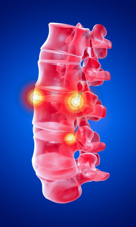 Lumbar Side View Stock Illustrations – 177 Lumbar Side View Stock ...