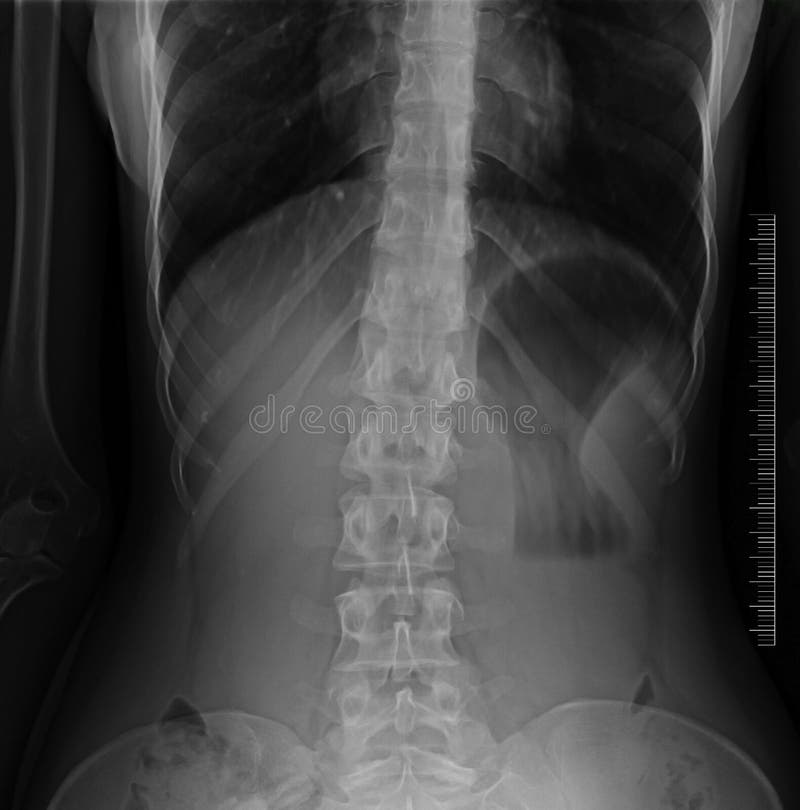 Lumbar spine/front view stock photo. Image of internal - 198780