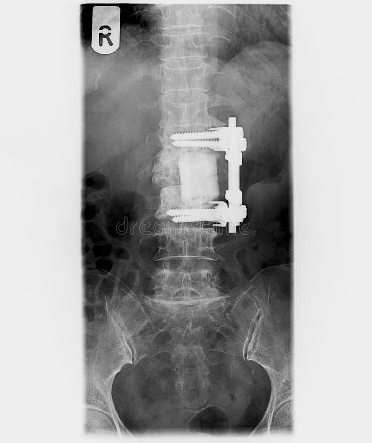 Whole Body Chiropractic Message Stock Photos - Free & Royalty-Free ...