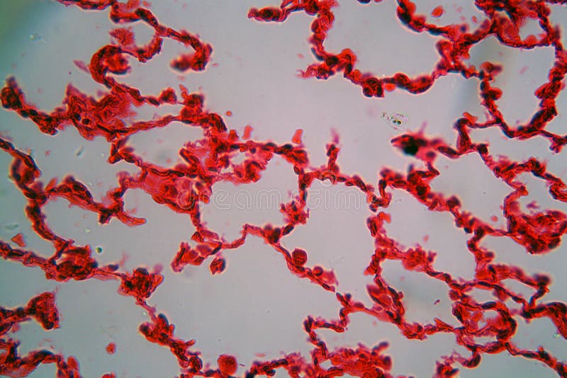 Lung Cells Under the Microscope Stock Photo - Image of pathology ...