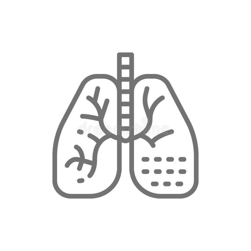 Lung Disease Line Icon. Isolated on White Background Stock Vector ...