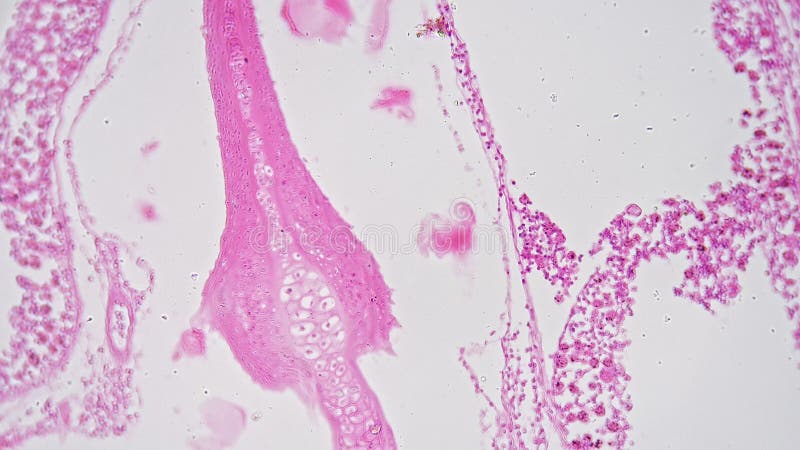 Lung of a Human in Longitudinal Section Filmed Under Microscope 400x ...