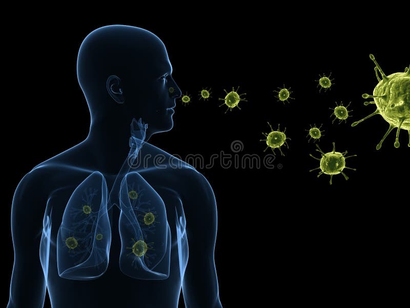 Lung bacteria stock illustration. Illustration of torso - 8692429