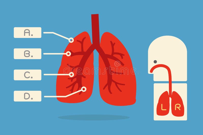 Lung infographic stock vector. Illustration of diagnostic - 32329844
