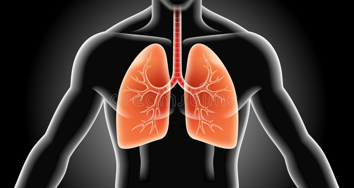 Lung Cancer Ray Chest Stock Illustrations – 563 Lung Cancer Ray Chest ...