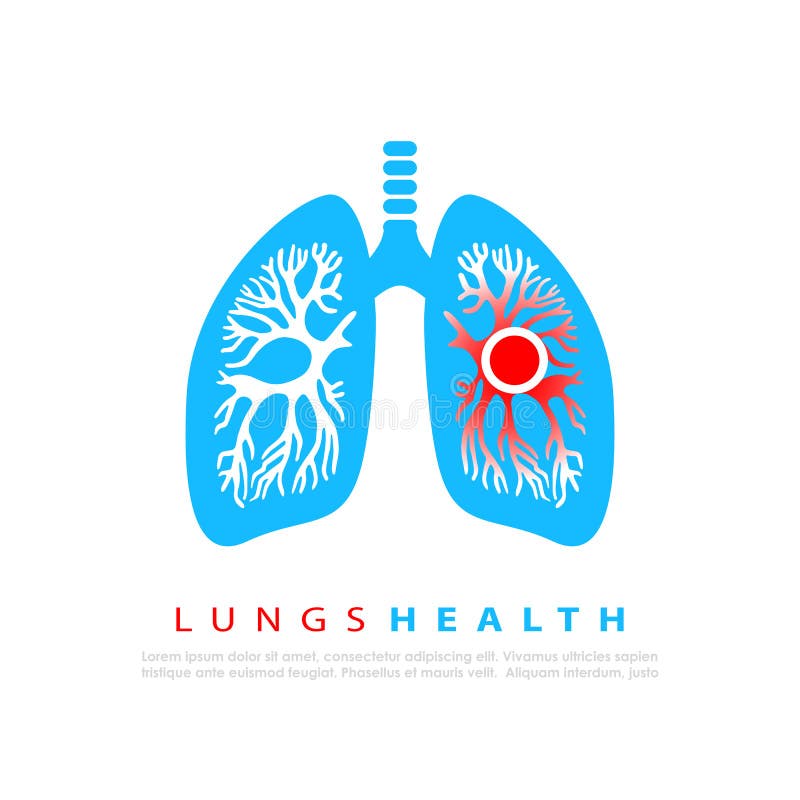 Lungs Infection Vector Logo Stock Vector - Illustration of icon ...