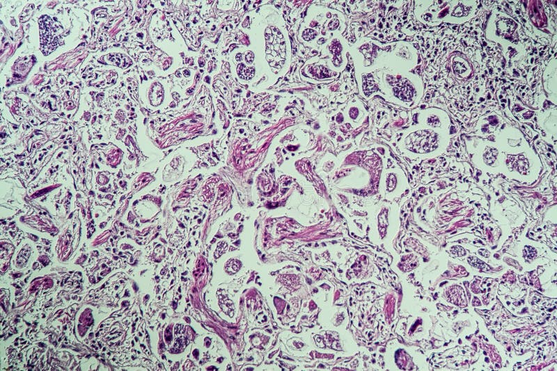 Lungworm Under the Microscope Stock Image - Image of wild, histology ...