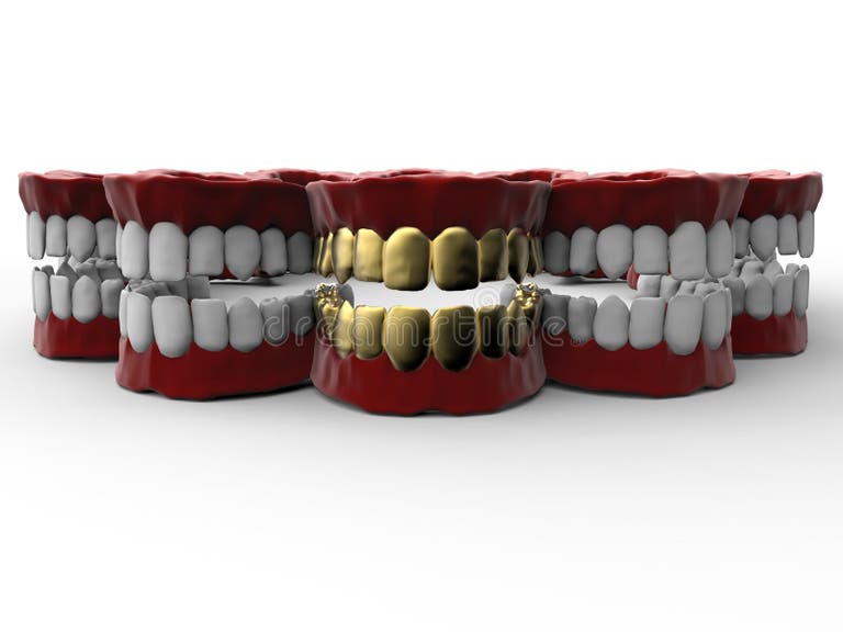 Luxury Denture Stock Illustrations – 104 Luxury Denture Stock ...