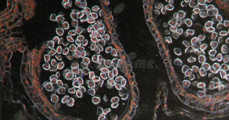 Lycopodium with Spores in Darkfield Stock Footage - Video of ...