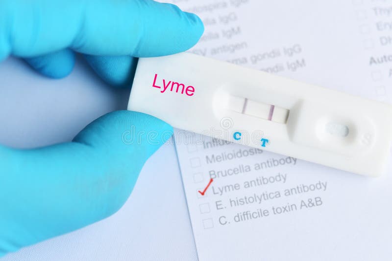 Lyme positive test result stock image. Image of biology - 121584913 Lyme positive test result stock image. Image of biology - 121584913