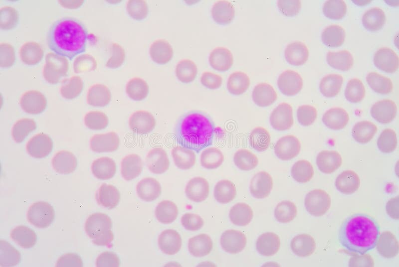 Lymfocyt stock foto. Image of geneeskunde, leukocyt, ziekte - 49362756