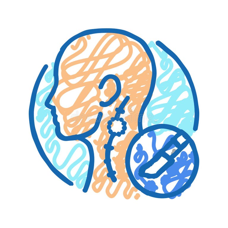 Lymph Node Dissection Surgery Icon Doodle Illustration Stock ...