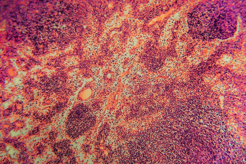 Pathogens Stomach Dog Stock Photos - Free & Royalty-Free Stock Photos ...