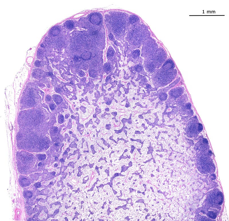 Lymph Connective Tissue