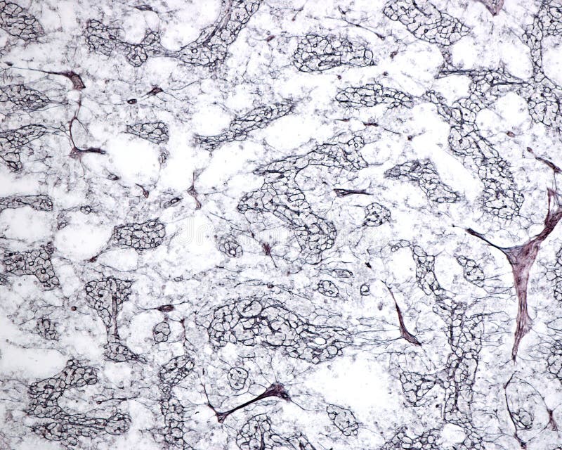 Lymph Node Medulla. Reticular Fibers. Silver Method Stock Photo - Image ...