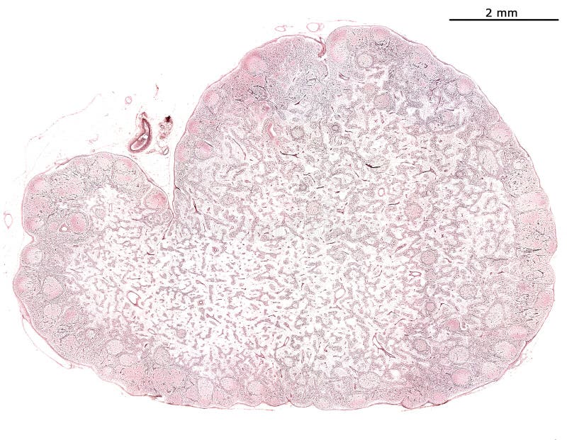 Reticular Meshwork Stock Photos - Free & Royalty-Free Stock Photos from ...