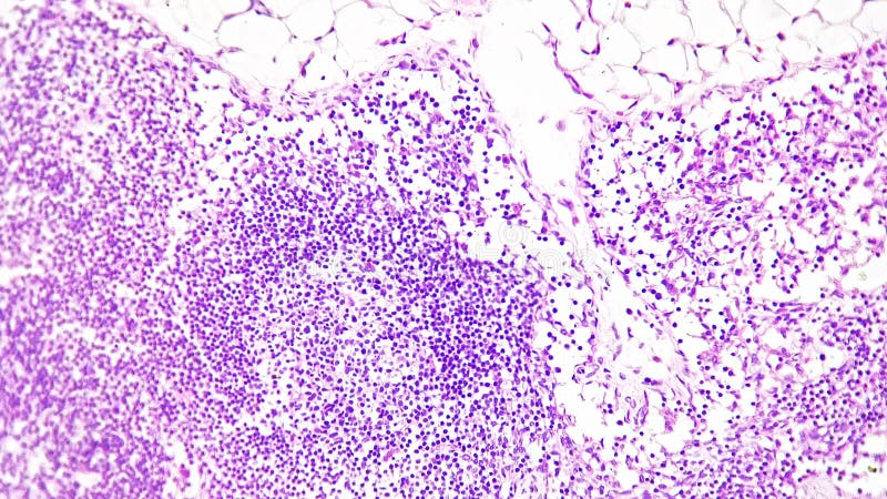 Lymph Node in Section Magnified Under Microscope in 400x Times on ...