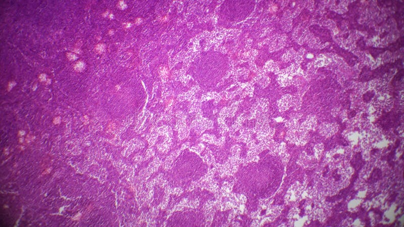 Lymph Node Section Under the Microscope Stock Image - Image of ...