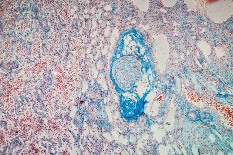 Lymph node tissue stock image. Image of science, magnification - 196730061