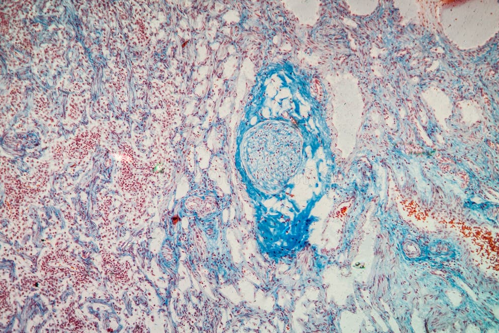 Lymph node tissue stock image. Image of science, magnification - 196730061