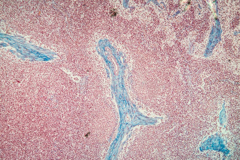 Lymph node tissue stock photo. Image of tissue, science - 196730080