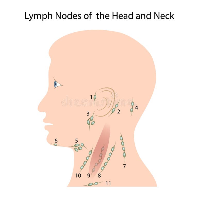 Lymph Nodes Neck Stock Illustrations – 470 Lymph Nodes Neck Stock ...