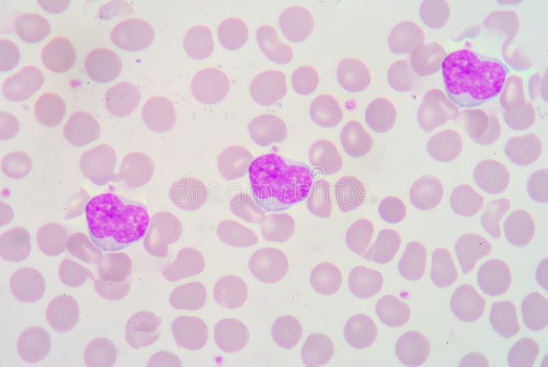 Lymphocyte photo stock. Image du lobé, rouge, immunisé - 49362788