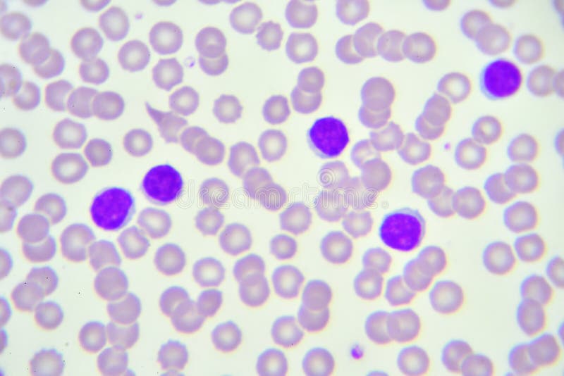 Lymphocyte cells stock photo. Image of health, neutrophil - 92594216