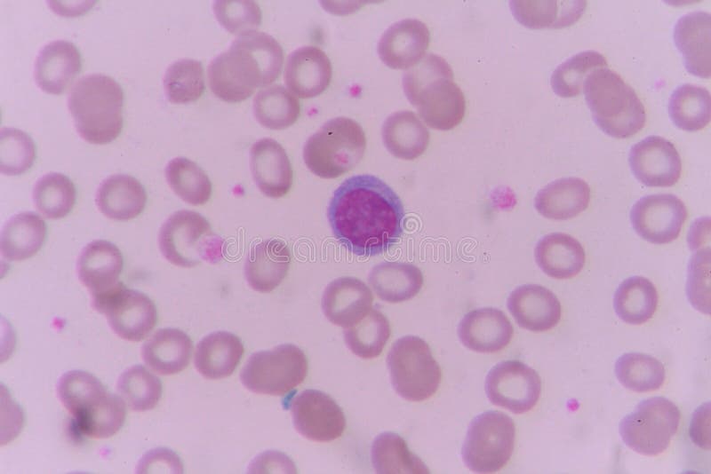 Lymphocyte stock image. Image of aids, blast, receptor - 58882049