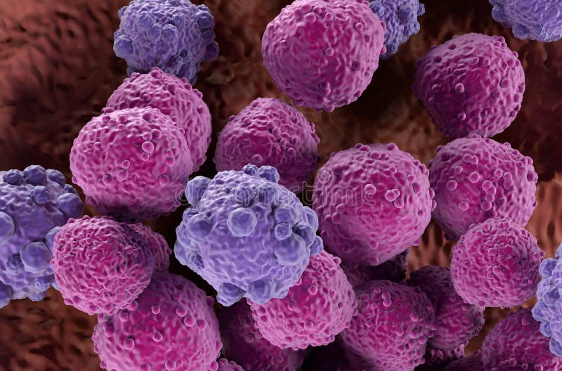 Lymphoma Cells - Isometric View 3d Illustration Stock Illustration ...