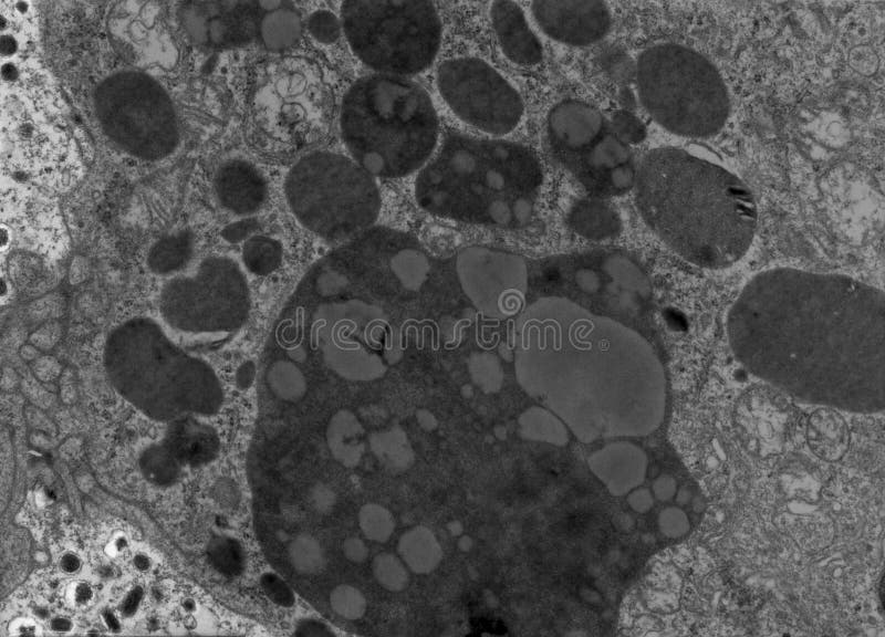 Lysosomes and Lipofuscin. False Colour TEM Stock Image - Image of ...