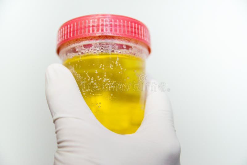 Recipiente De Urina Para Ensaios E Instrumentos Laboratoriais Conceito ...