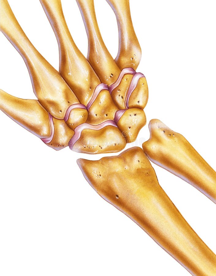 Ossos De Carpal X Ray Humano Imagem de Stock - Imagem de paciente ...