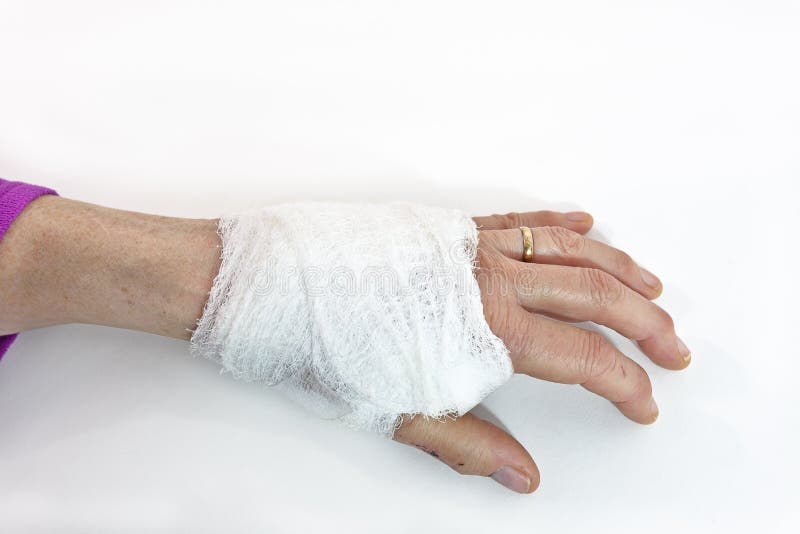 Perna Fêmea Curada E Perna Com Curativo Gaze. Autoajuda Adequada Para ...