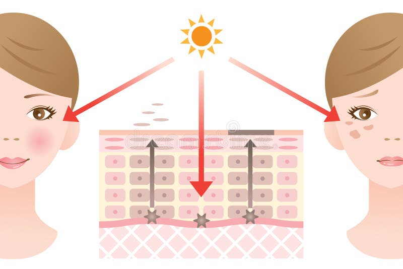 Taches Brunes Sous L'oeil Pigmentation Sur Le Visage Photo stock ...