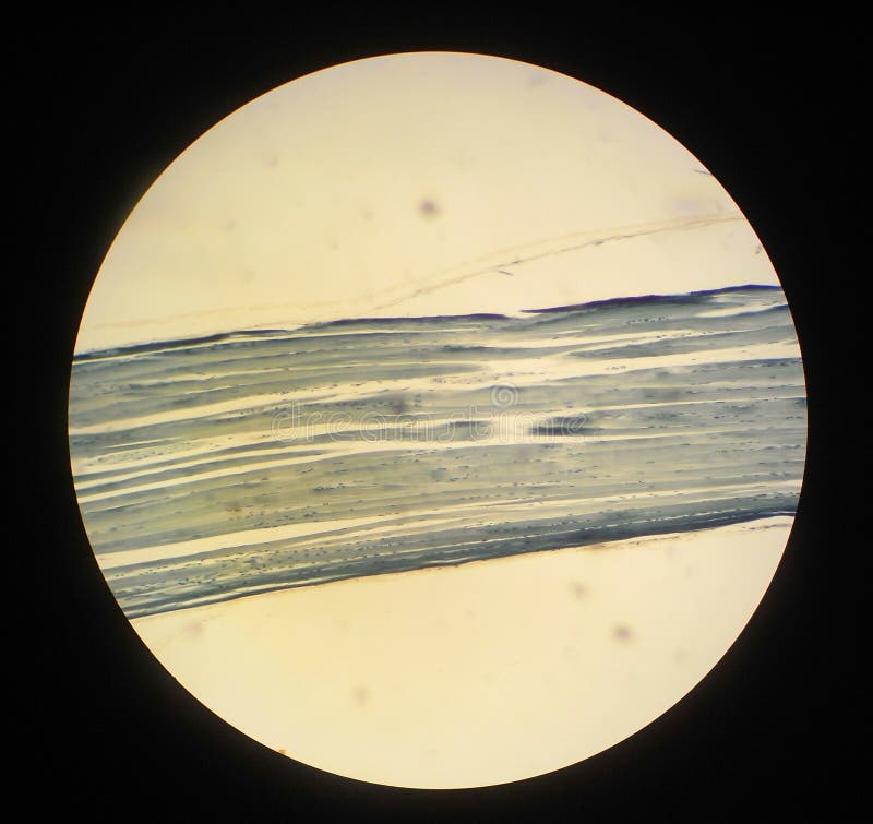 Músculo estriado foto de archivo. Imagen de animal, célula - 26208374