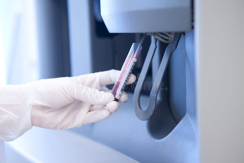 Machine d'analyse de sang image stock. Image du sang - 14015961