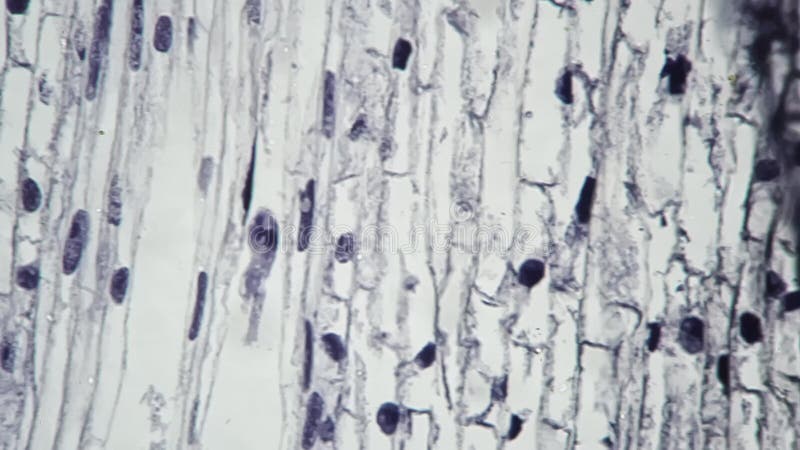 Root Tip of Allium Cepa in Longitudinal Section Magnified by Microscope ...