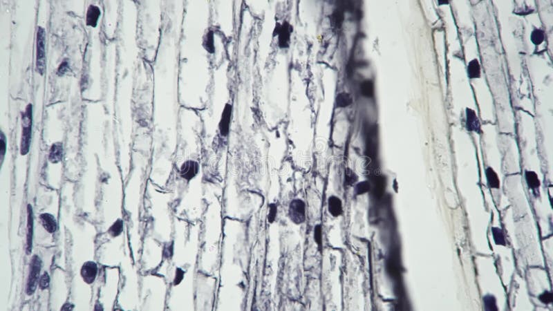 Root Tip of Allium Cepa in Longitudinal Section Magnified by Microscope ...