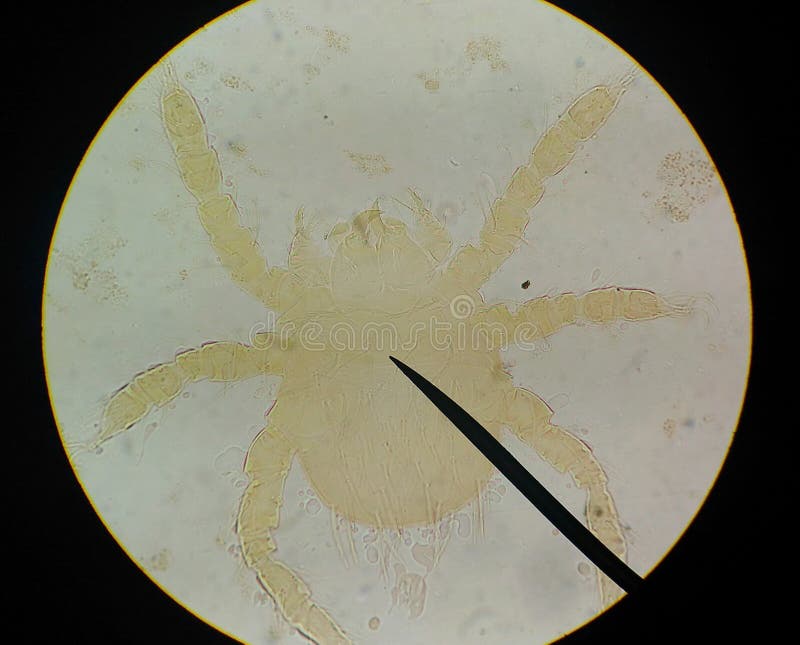 Macro Animal Parasite Find with Microscope. Stock Photo - Image of ...